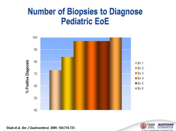Best Approach for Identifying Eosinophilic Esophagitis | gutsandgrowth