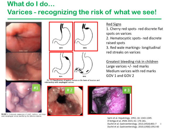 varices | gutsandgrowth