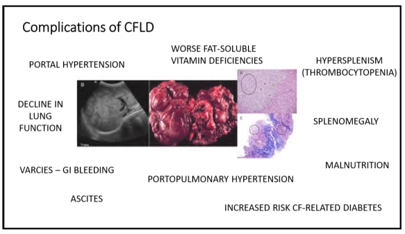 distal intestinal obstruction syndrome | gutsandgrowth