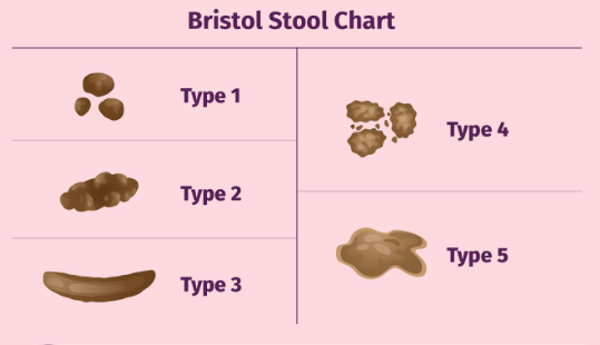 Reliable Scoring System for Constipation Management | gutsandgrowth