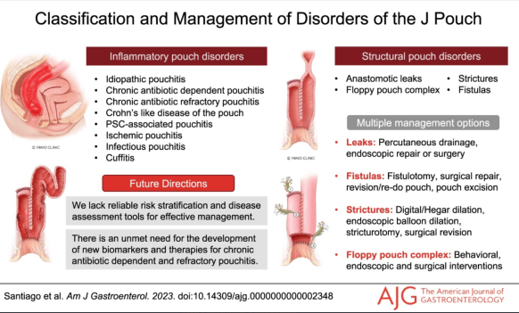 Endoscopy of the Ileal Pouch Anal Anastomosis | gutsandgrowth