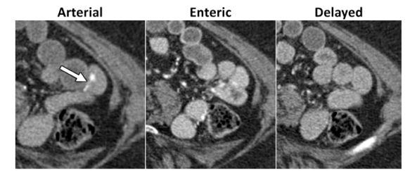 Gastroenterology | gutsandgrowth