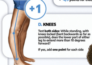 Expert Advice for GI Manifestations of Hypermobile Ehlers-Danlos ...